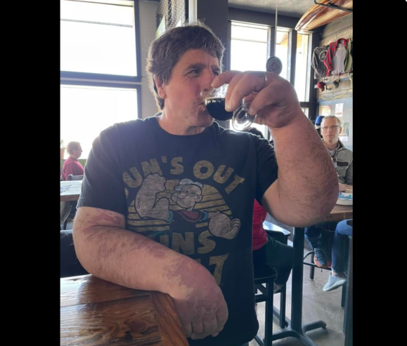This Minnesota Man Has Very Large Arms and 1.1 Million TikTok Followers ...